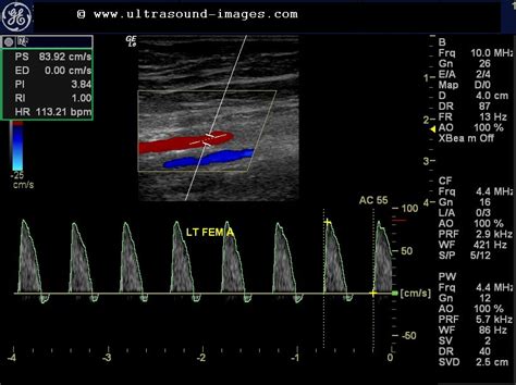 Ultrasound Imaging October 2012