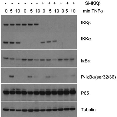 The Role Of Ikka And Ikkb In P65 Phosphorylation And Ikba Degradation Download Scientific