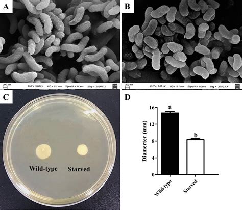 Vibrio Cholerae Microscope