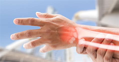 Osteoarthritis Home Care Dubai Mrod Healthcare