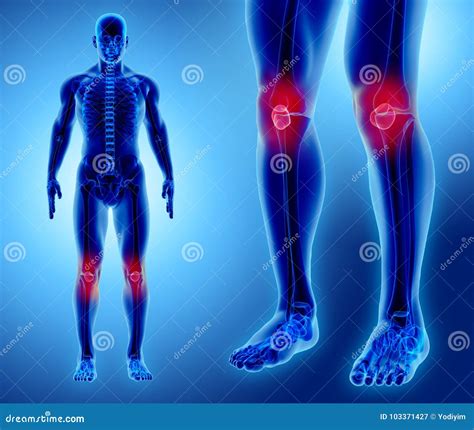 3d Illustration Of Patella Medical Concept Stock Illustration