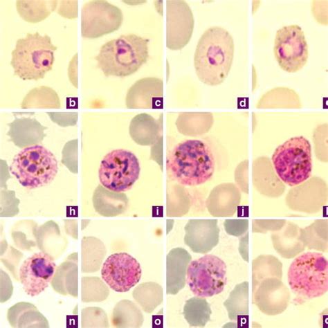 Malaria Plasmodium Species My Xxx Hot Girl