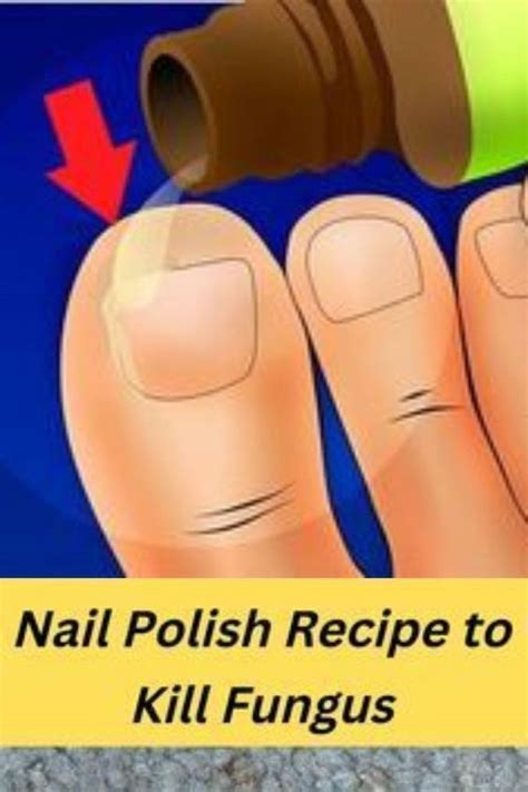 Pin On Fungal Nail Removal