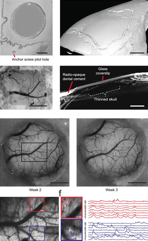 Demonstration Of The Craniobot Surgical Capabilities A A Micro Ct