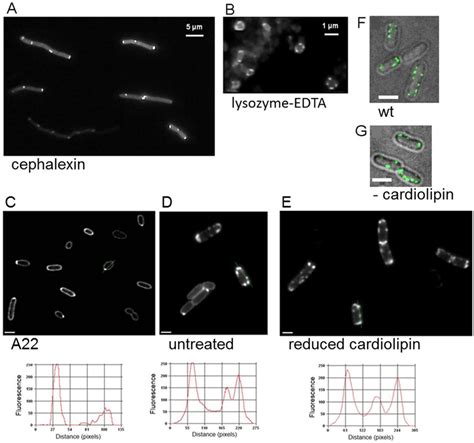E Coli Cells Expressing Dcus Yfp In Filaments In Spheroplasts And In