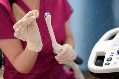 Gynecologist Places Ultrasound Probe Cover On A Transvaginal Ultrasound