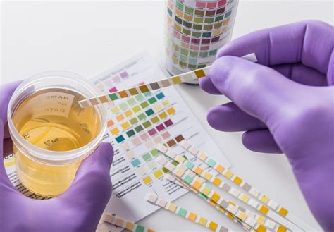 Cms Recognizes 3 New Clia Waived Cw Tests G2 Intelligence