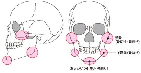 小顔形成術（小顔整形・輪郭3点）｜ 池袋の美容整形・美容外科（小顔整形・顔痩せ・輪郭整形）｜みずほクリニック