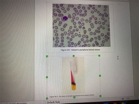 Solved 67 The Patient Was A 46 Year Old Male Who Presented Chegg