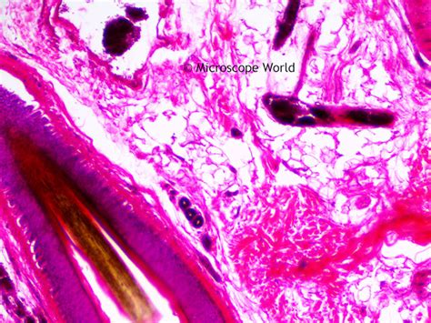 Microscope World Blog Scalp With Hair Under The Microscope