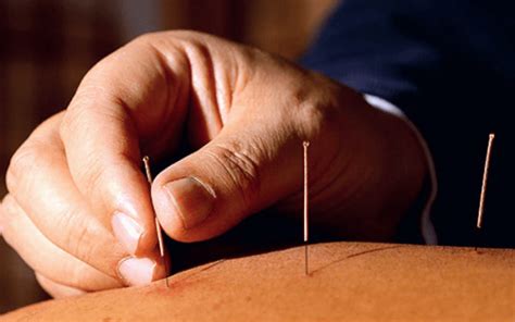Home Purple Cloud Chinese Medicine Acupuncture Hobart