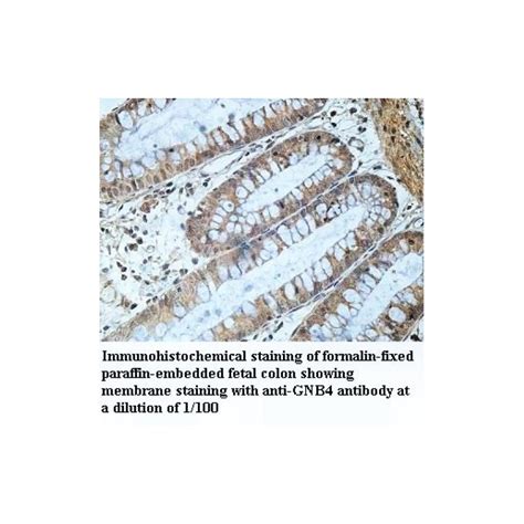 Gnb4 Antibody Supplier Cas Aobious