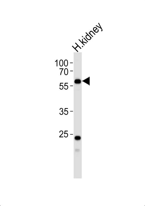 Pfkfb3 Antibody C Term Purified Rabbit Polyclonal Antibody Pab Wb