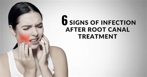 Root Canal 6 Signs Of Infection After Root Canal Treatments
