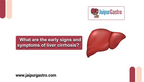 What Are The Early Sign And Symptoms Of Liver Cirrhosis