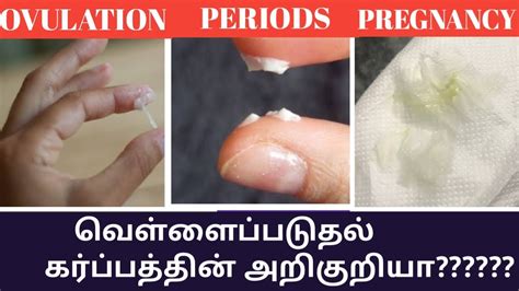 Vaginal Discharge Early Pregnancy