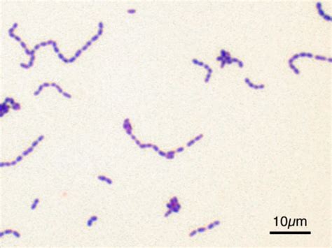 Difference Between Streptococcus And Staphylococcus Definition