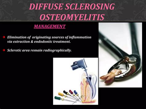 Osteomyelitis Of Jaw Pptx