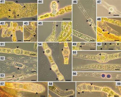 Brown Algae Microscope