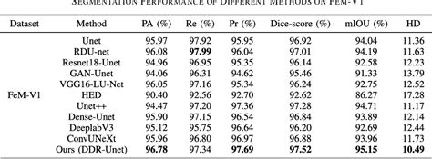 table ix from ddr unet a high accuracy and efficient ore image segmentation method semantic