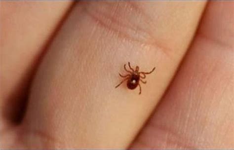 Another Case Of Congo Virus Reported In Karachi Such Tv