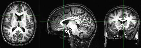 afni tutorial 3 looking at the data — andy s brain book 1 0 documentation