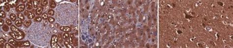Anti Nqo2 Antibody Clone 4a4 1 Clone 4a4 1 From Mouse