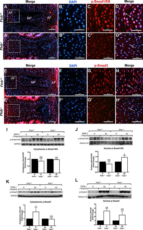 Tgfβ And Bmp Pathway Components Exhibit Nuclear Localization In