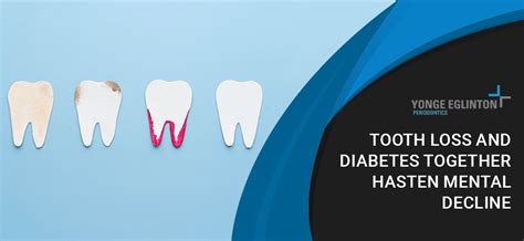 Tooth Loss And Diabetes Together Hasten Mental Decline