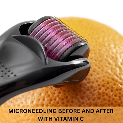Microneedling Before And After With Vitamin C The Naked Chemist