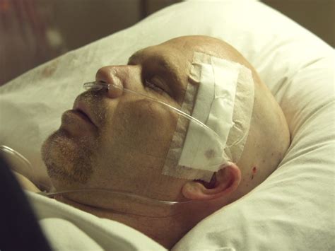 Pictures Of Moyamoya Disease Sufferers And Their Famlies