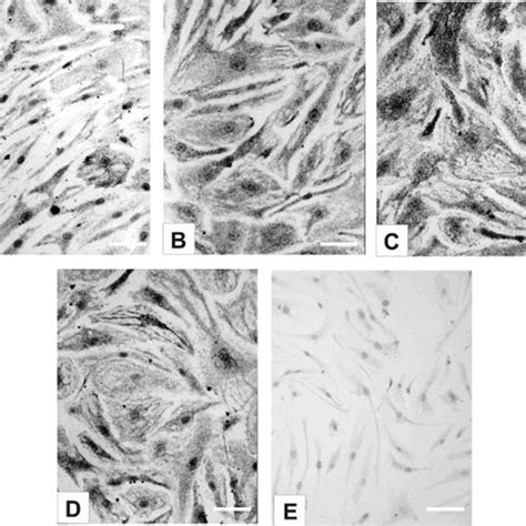 Intracellular Localization Of Ccl3 In Hbmec By Immunogold Silver