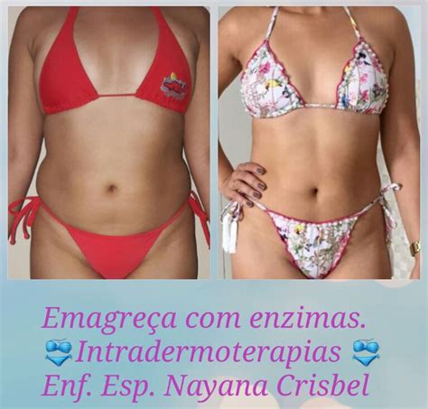 Palpite Emagrecimento rápido através de aplicações de enzima você já