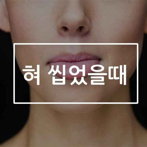 혀 씹었을 때 너무 세게 물었을 때 대처법은 네이버 블로그