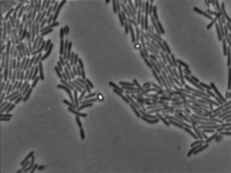 Clostridium Tetani Electron Micrograph