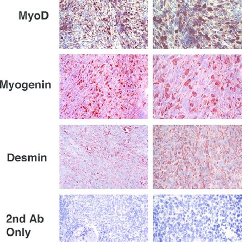 Reduced Expression Of Glycosylated Dystroglycan And Sarcoglycan In Mdx
