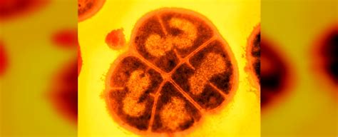 This Microbe Eats Radiation For Breakfast Now We Know Its Secret