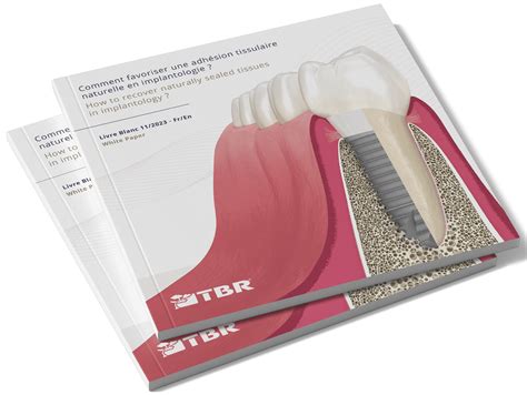 Accueil Tbr Dental