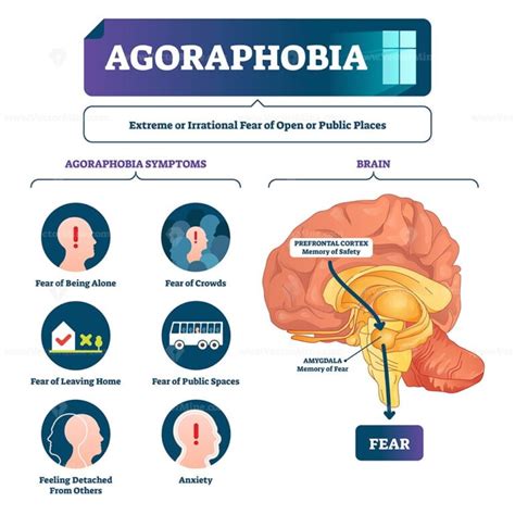 Agoraphobia Vector Illustration Vectormine