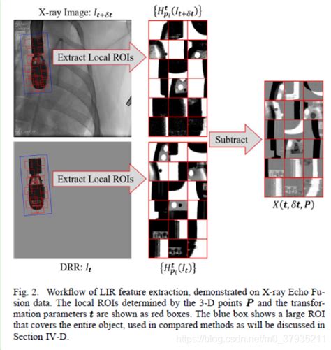 【配准】2019医学图像配准中的深度学习综述论文解读（1）deep Learning In Medical Image