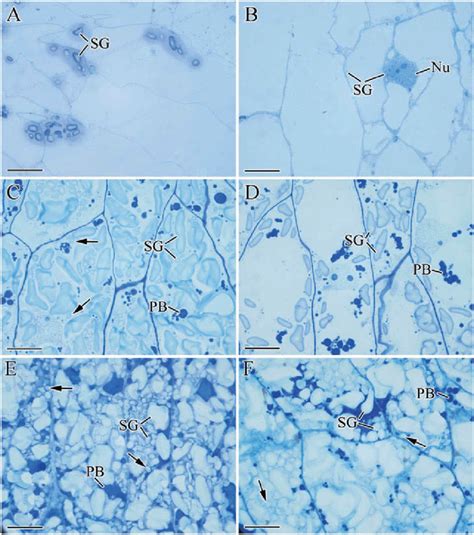 Development Of Starch Granules In Central Endosperm Cells Cecs A