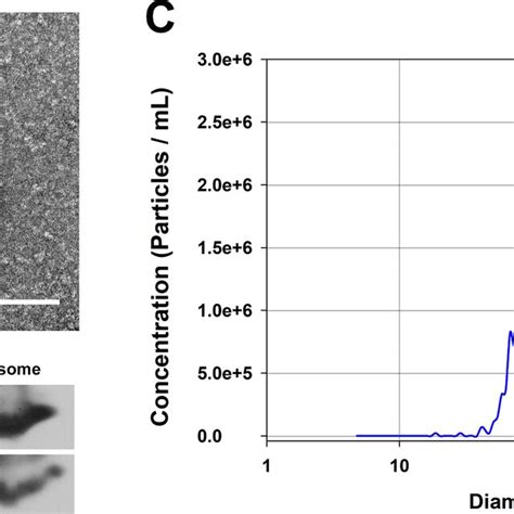 Characterization Of Follicular Fluid Derived Exosomes A Transmission