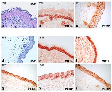 The Alphabeta Carboxy Terminal Domains Of P63 Are Required For Skin
