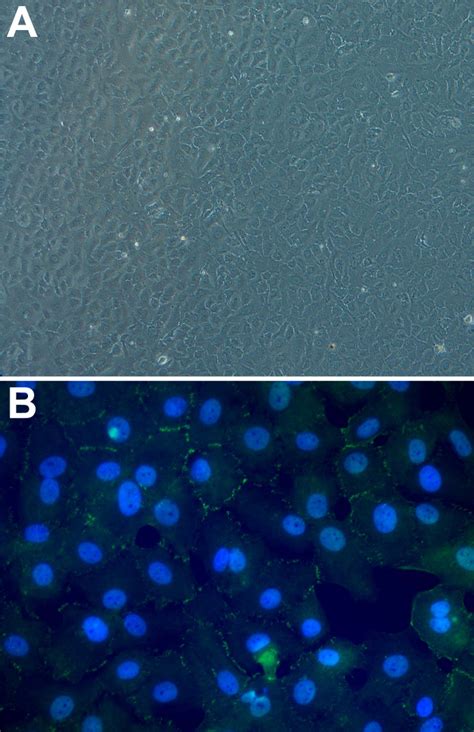 Human Corneal Endothelial Cell Examination Inverted Phase Contrast