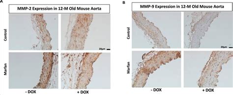 Rabbit Mouse Dual Hrp Dab Detection Ihc Kit Colorimetric Ab236466 Abcam