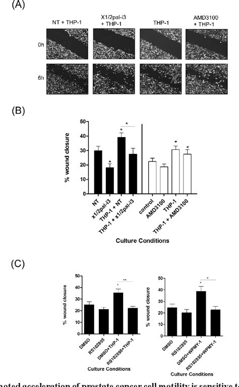 Figure 1 From Tumor Derived Cxcl8 Signaling Augments Stroma Derived Ccl2 Promoted Proliferation