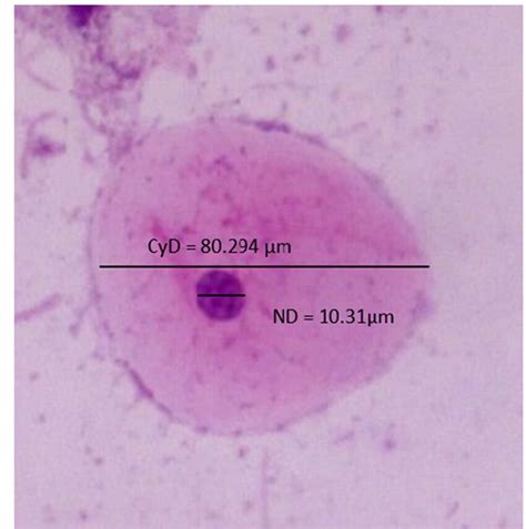 Cytological Smear Showing Nuclear And Cytoplasmic Diameters Download Scientific Diagram
