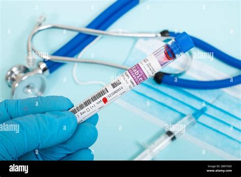 Fictional Blood Samples With Infected Rabies Virus With Stethoscope