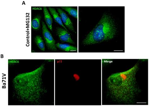Analysis Of Histone Deacetylase 6 Hdac6 Colocalization With African