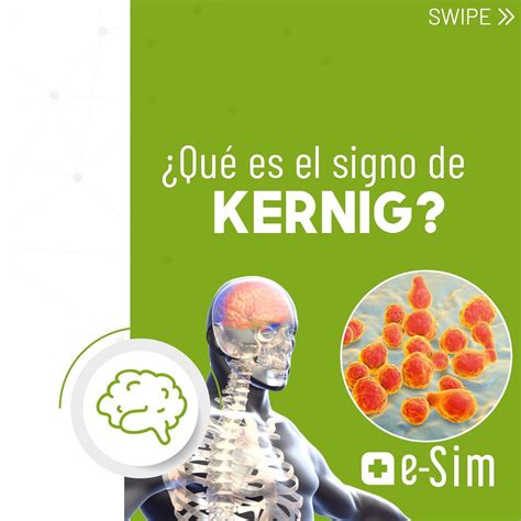 El Signo De Kernig Y E Sim Educación Para Emergencias